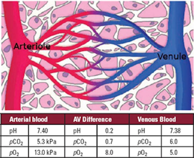 Capillary-blood gases: To arterialize or not | Medical Laboratory Observer