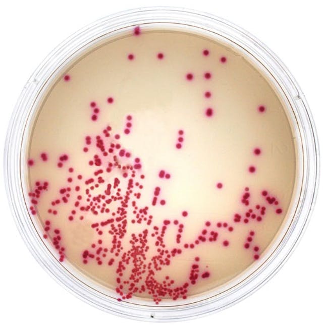 HAI prevention and control: rapid MRSA screening methods | Medical ...