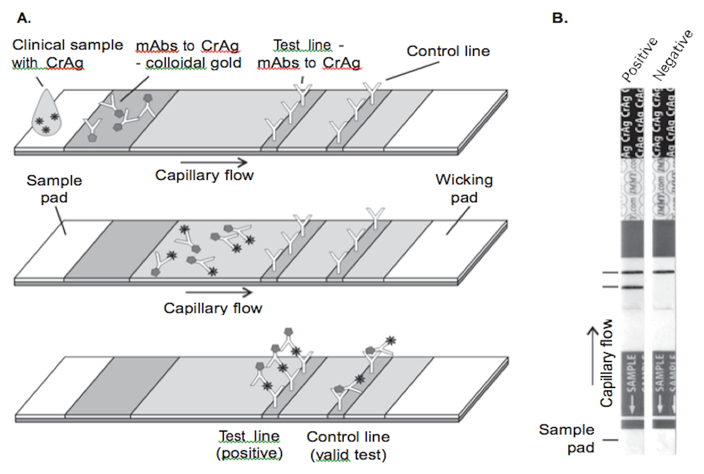 Sensitivity and specificity of a new cryptococcal antigen lateral flow ...