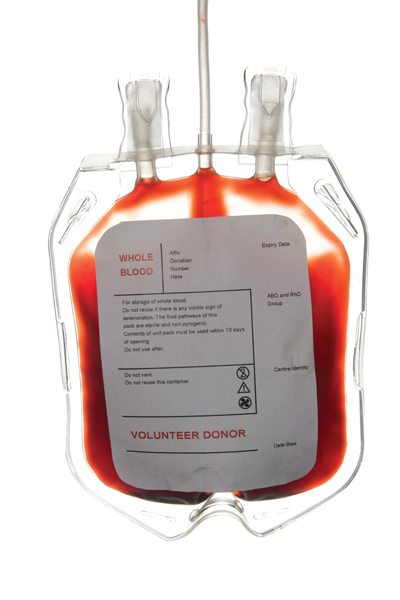 Best practices for reducing unnecessary preoperative blood orders and ...