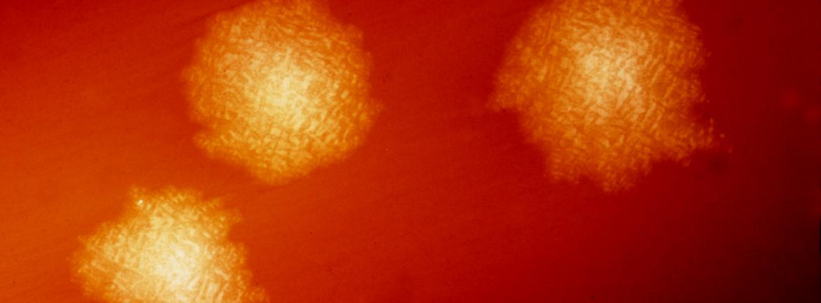 Multistep algorithm testing accurately identifies C. diff patients who ...