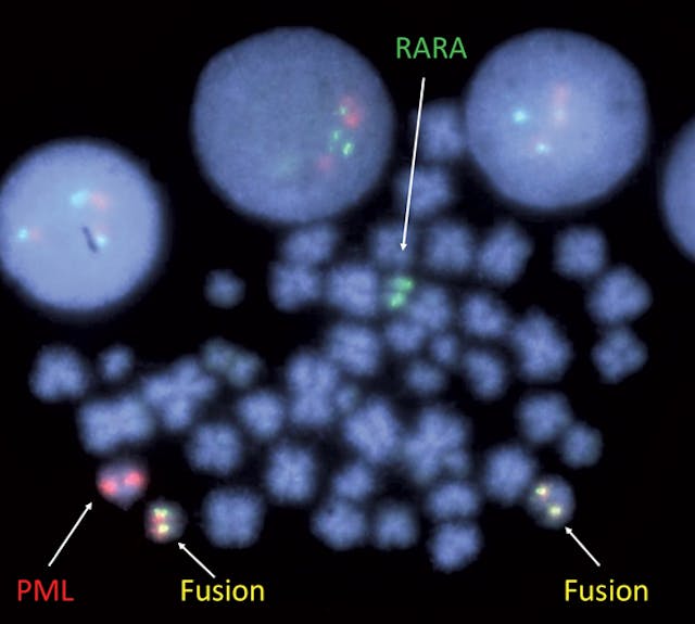 FISHing in the genomic testing age | Medical Laboratory Observer