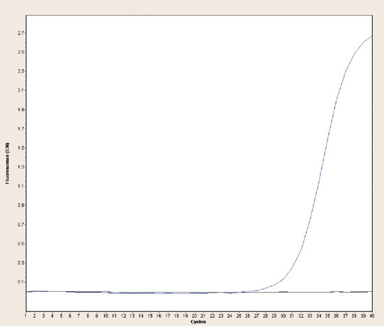 Endpoint PCR detection | Medical Laboratory Observer