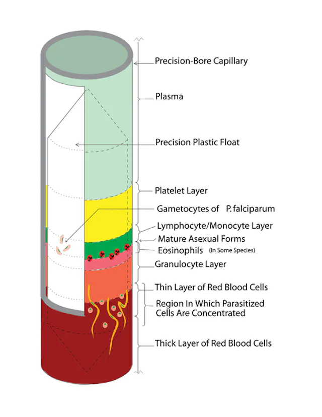 Dry hematology: its development, function, and role in point of care ...