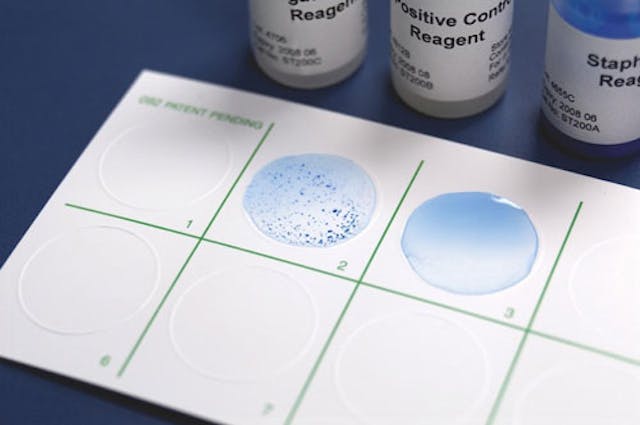 HAI prevention and control: rapid MRSA screening methods | Medical ...