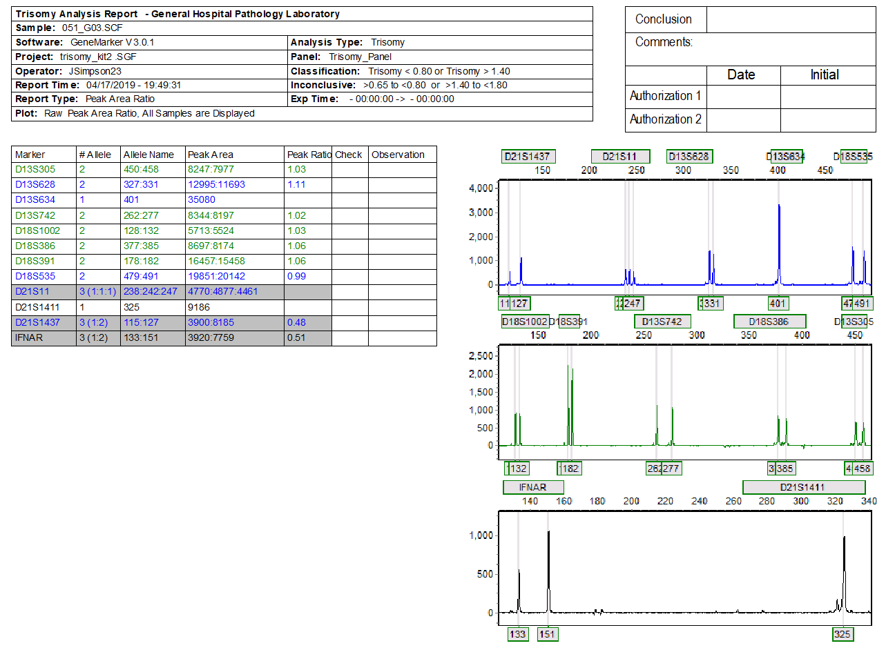 Qfpcr Prenatal Diagnosis Of Aneuploidies And Microdelation/duplication