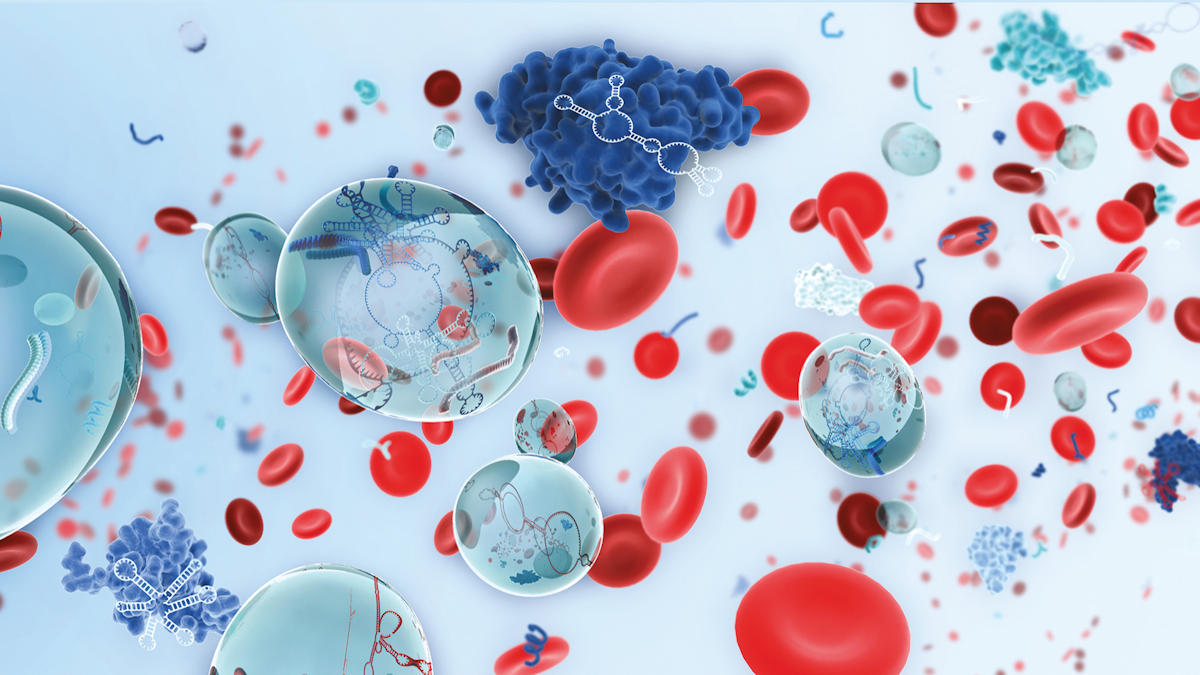 Liquid biopsy in cancer management | Medical Laboratory Observer