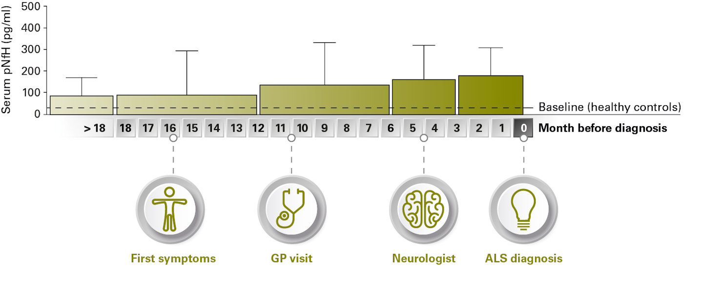 New biofluid biomarkers in neurodegeneration | Medical Laboratory Observer