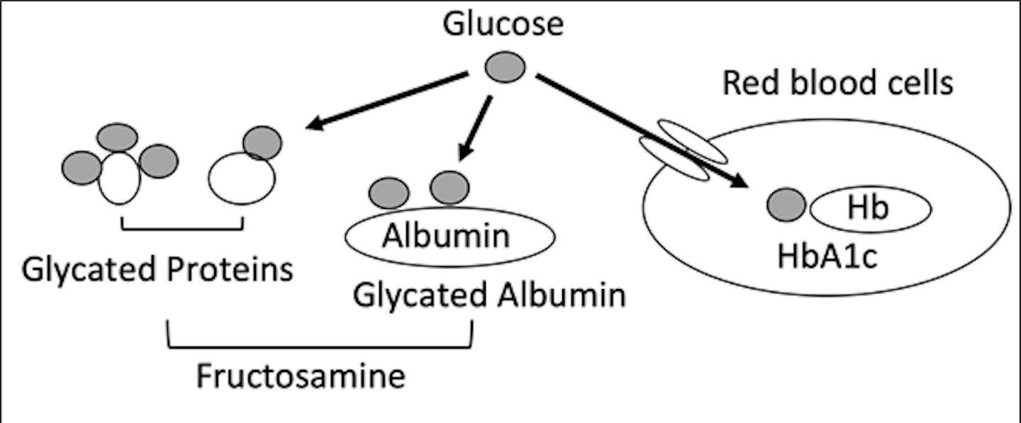 Glycated albumin – utility and distinction vs A1C and fructosamine ...