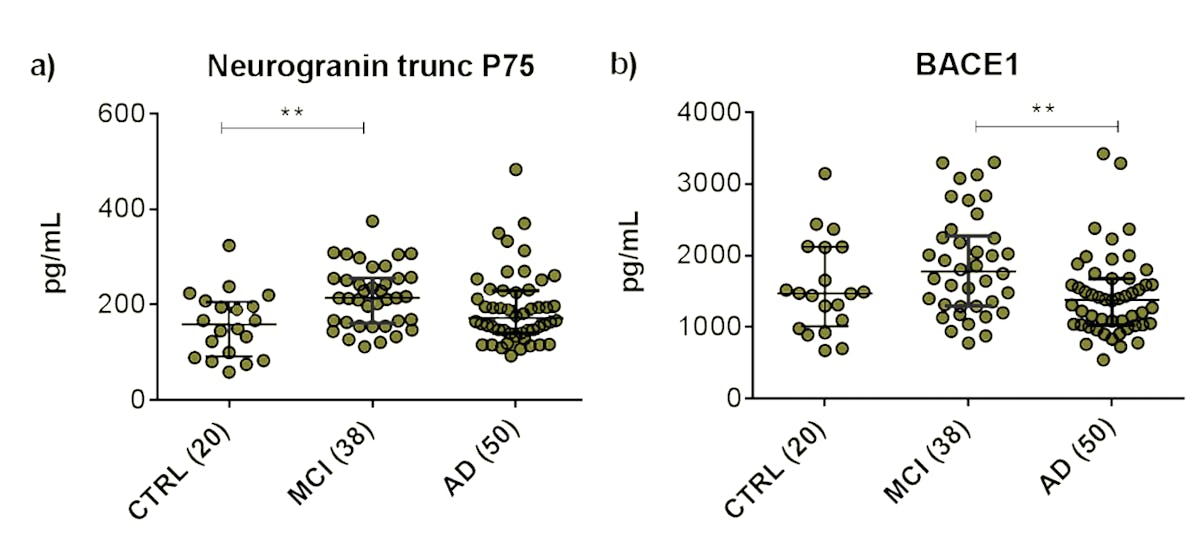 New biofluid biomarkers in neurodegeneration | Medical Laboratory Observer