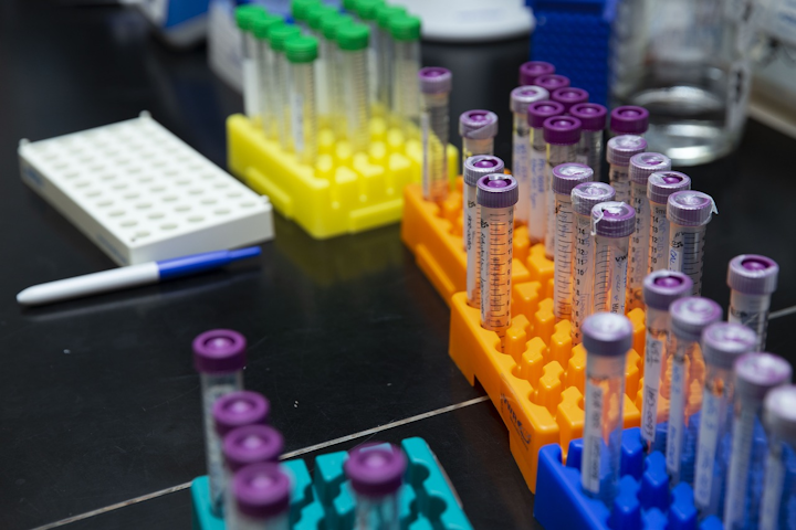 HHS funds testing capacity for government labs | Medical Laboratory ...