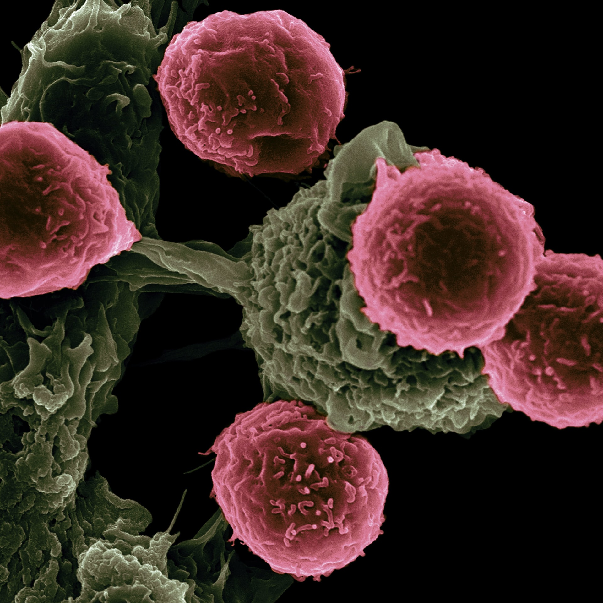 Recycling t-cells into super soldiers | MLO Online