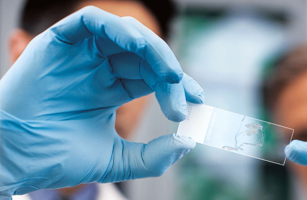 Liquid biopsies easing diagnosis | Medical Laboratory Observer