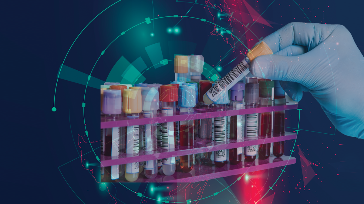 Minimizing Laboratory Errors With Automation Medical Laboratory Observer