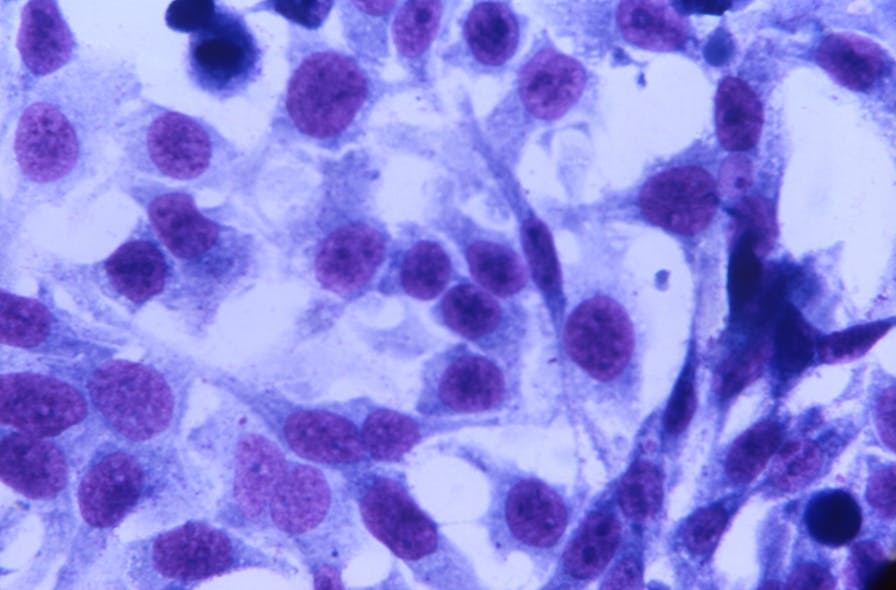 FDA approves treatment for post-transplant cytomegalovirus (CMV ...