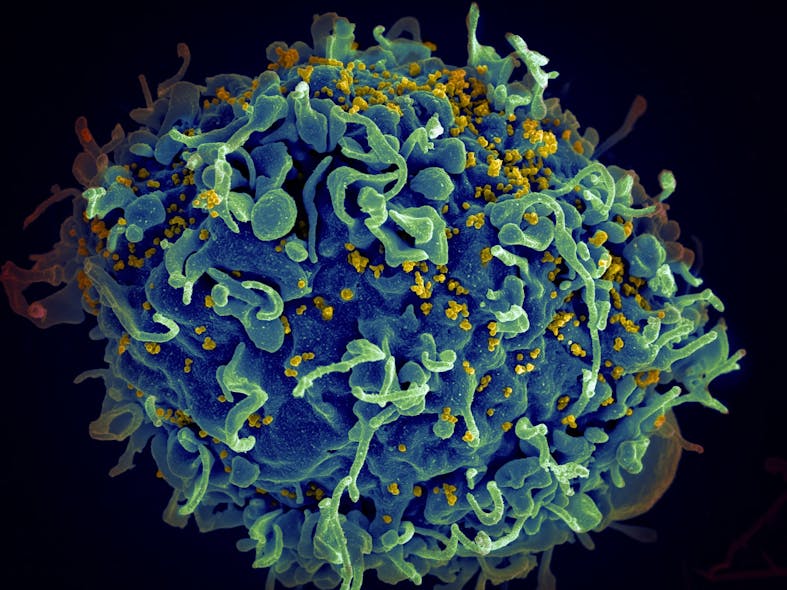 Study shows how HIV copies itself in the body | Medical Laboratory Observer
