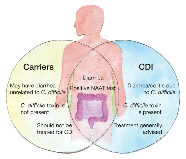 Testing for Clostridioides difficile and its disease | Medical ...