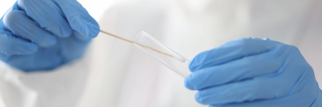 CDC establishes specimen collection guidelines after confirmed U.S ...