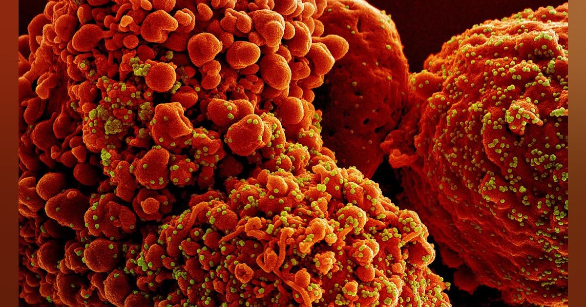 Nih Funded Team Develops Method To Identify Future Sars Cov 2 Mutations