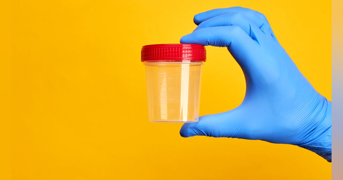 A new urine test could help curtail the use of the latest synthetic ... A new urine test could help curtail the use of the latest synthetic ...