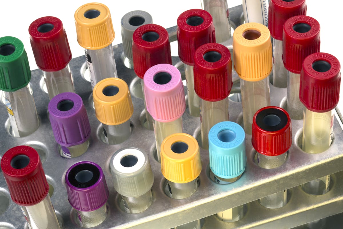 The most purely patient-based quality control: A novel application of ...