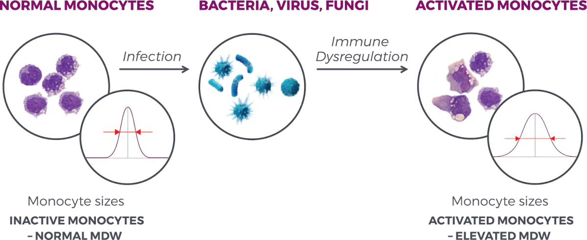 Understanding sepsis: The importance of biomarkers in early diagnosis ...