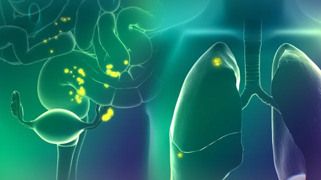 On Target Laboratories announces expanded indication of CYTALUX ...