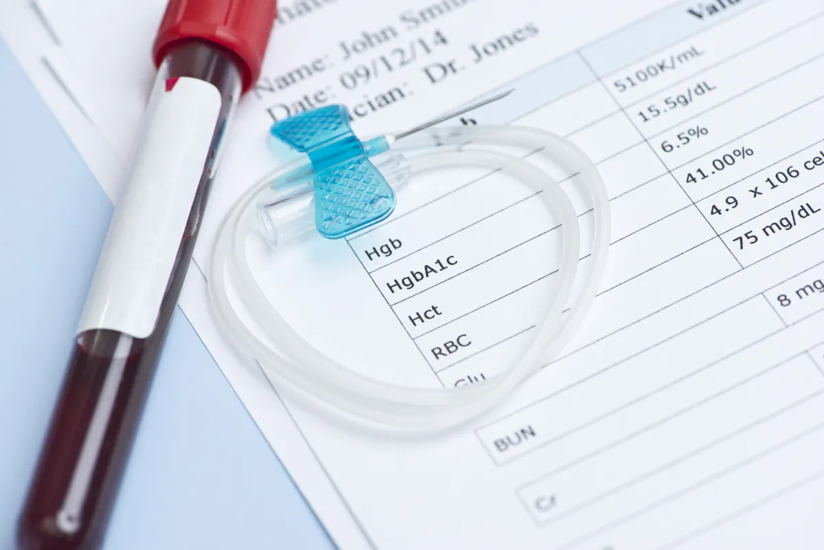 Importance of hemoglobin A1c testing for diabetes diagnosis and ...