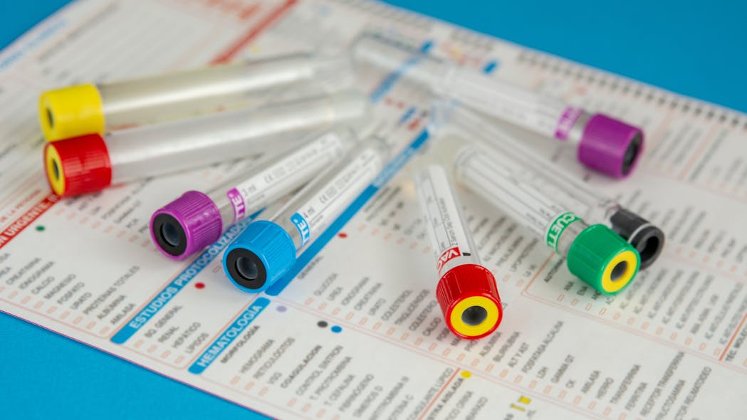 Children’s Hospital Los Angeles develops liquid biopsy test for ...