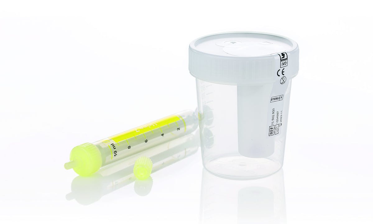 Product Focus - Specimen Collection | Medical Laboratory Observer