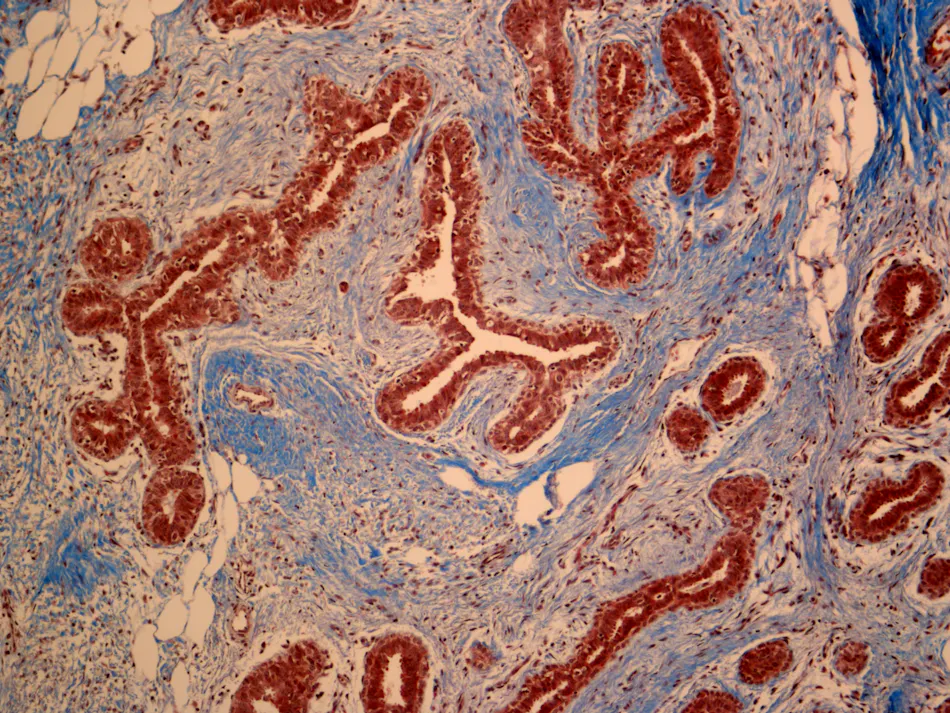 Atlas of normal breast cells brings insights into mammary biology ...