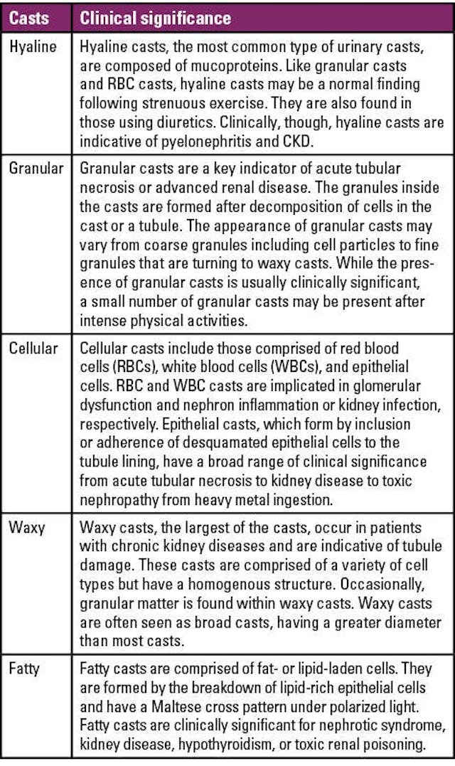 Urinary casts: Indicators of underlying clinical pathology | Medical ...