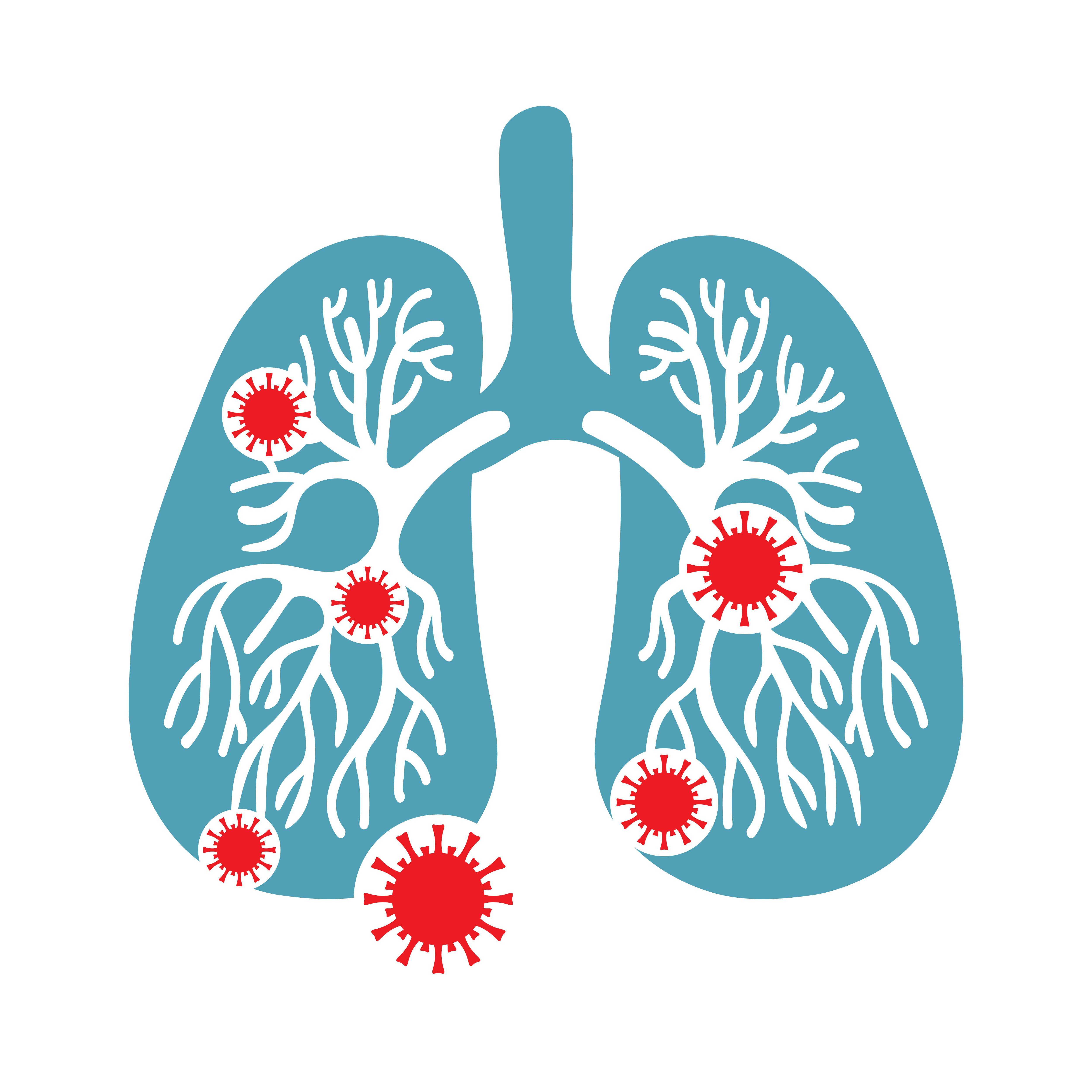 CDC updates and simplifies respiratory virus recommendations | Medical ...