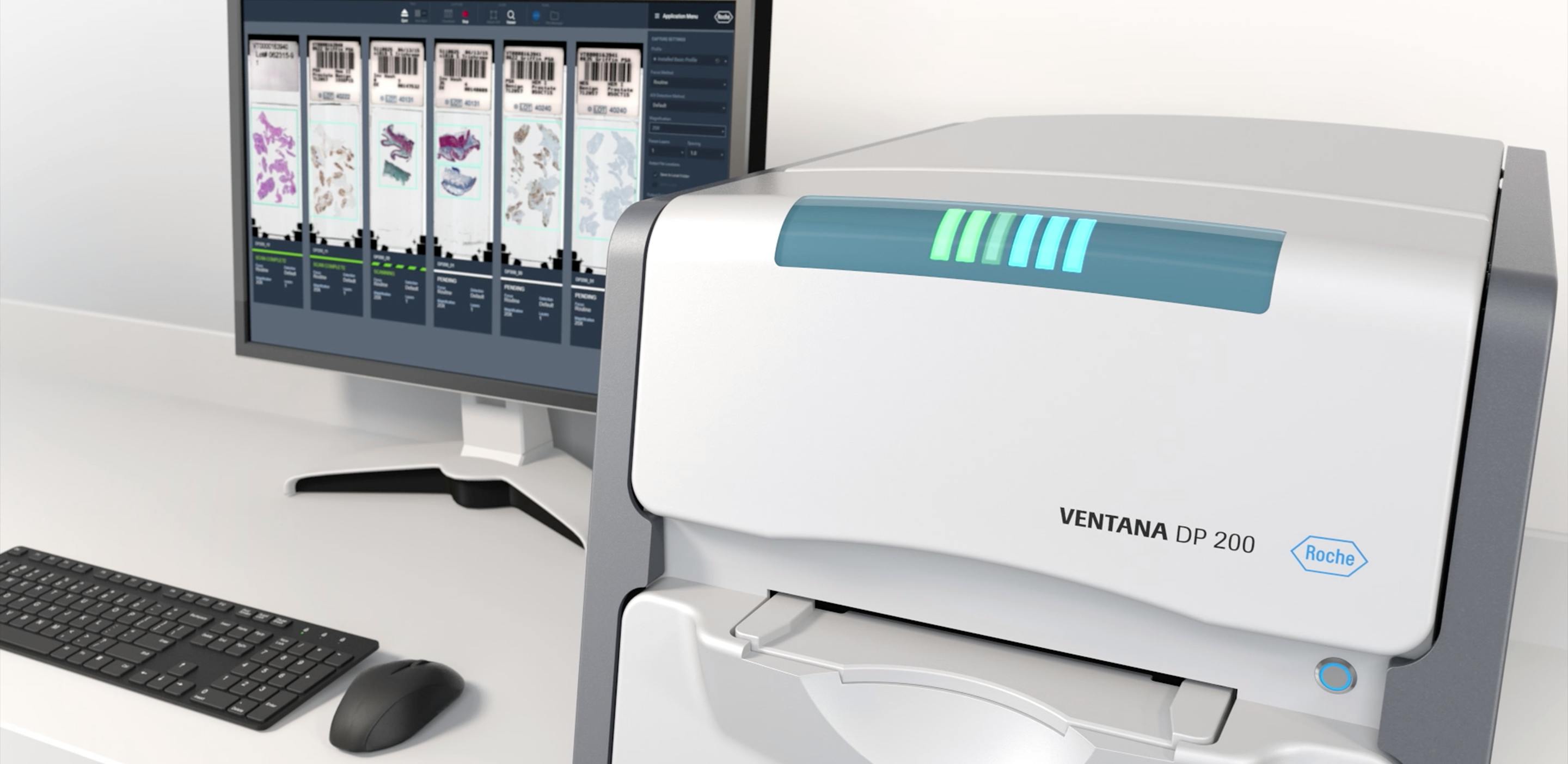 Roche receives FDA clearance on its digital pathology solution for ...