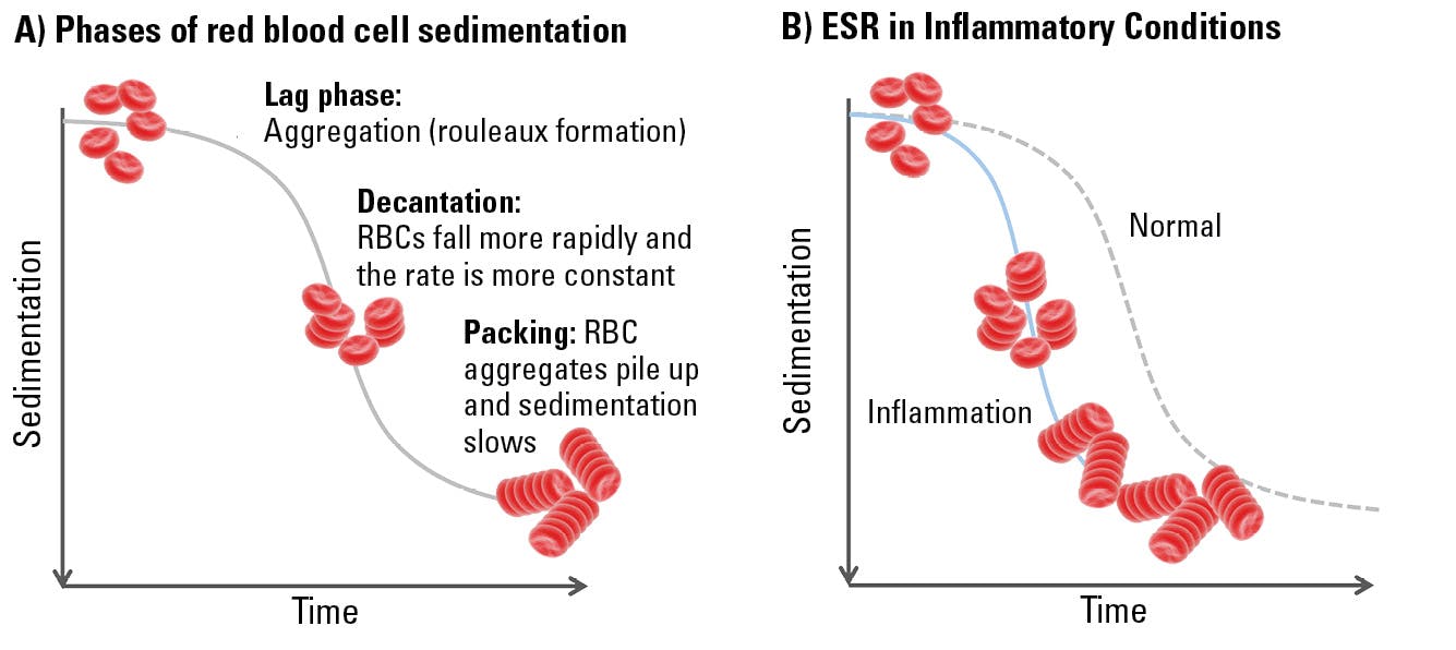 The (r)evolution of ESR: Photometric rheology | MLO Online